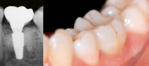 ITI Treatment Guide 14 - ITI Campaigns