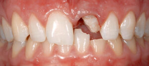 ITI Treatment Guide 14 - ITI Campaigns